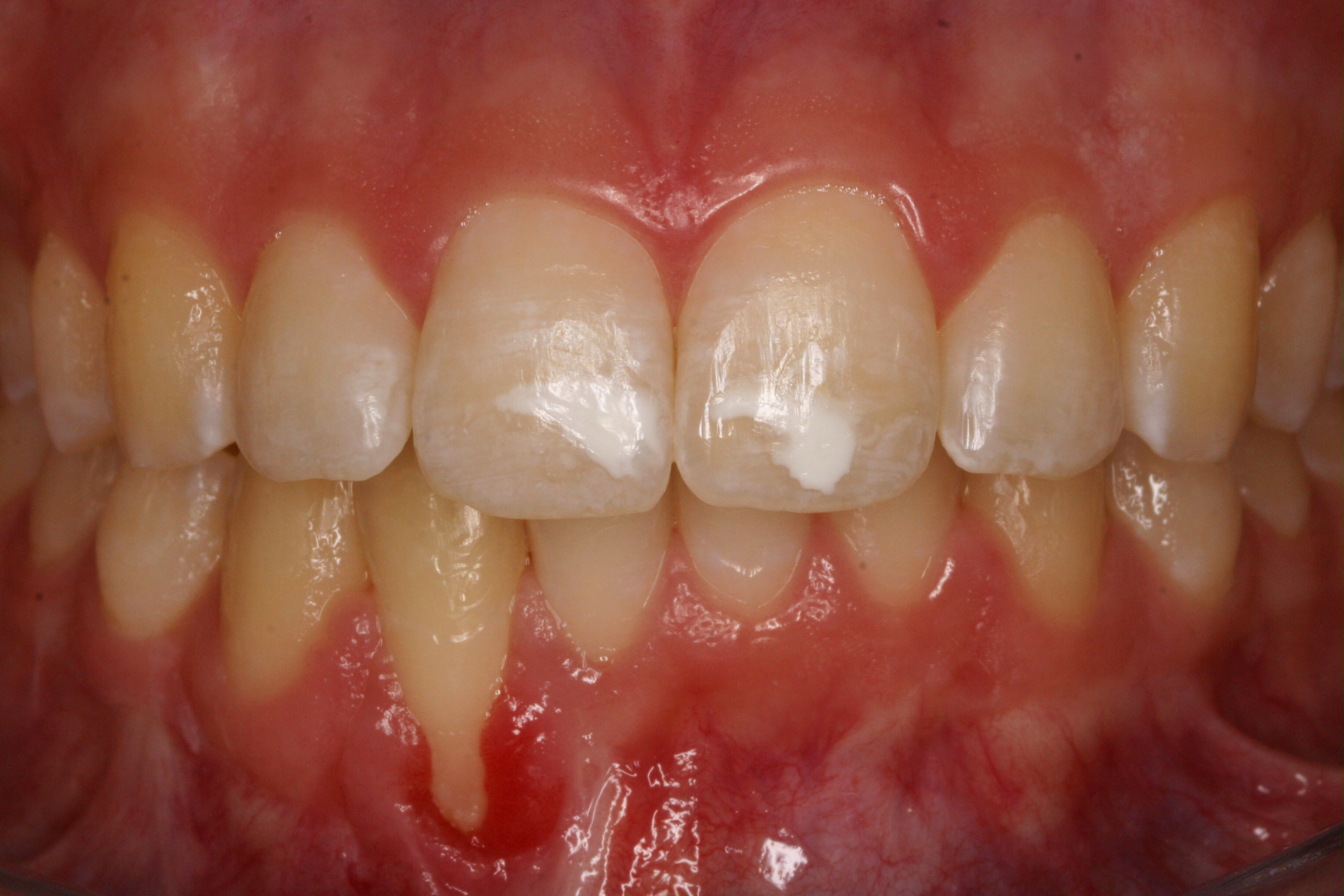 Parodontologie Praktijk - Utrecht, Implantologie-Utrecht - Gallery 6